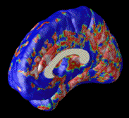 3D imaging of hippocampal cell death in Alzheimer’s | Mo Costandi